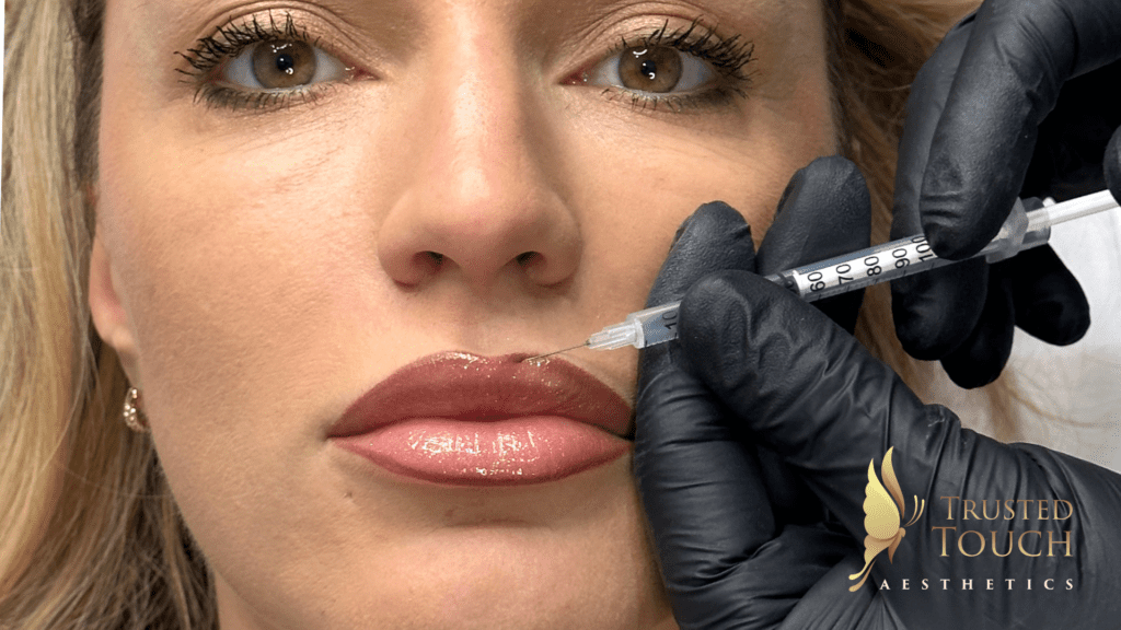 Filler Dissolving - Botox and fillers Trusted touch aesthetics, Fulham.